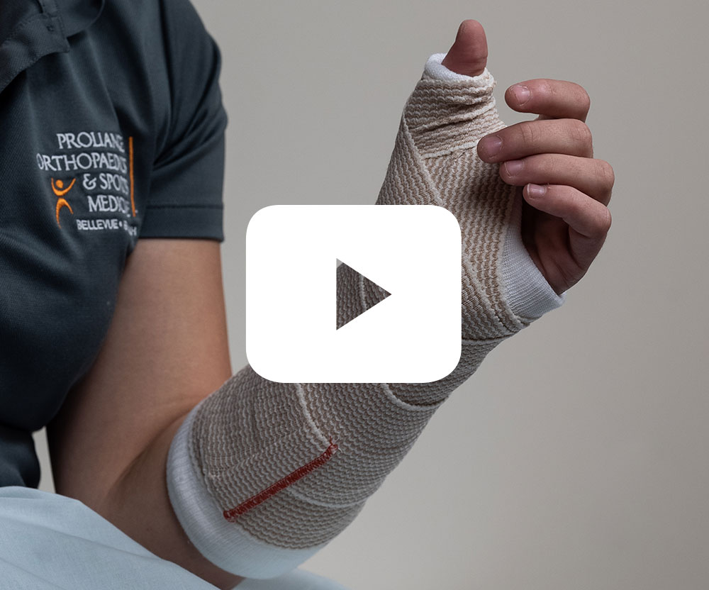 Physician Splinting Guide Proliance Orthopaedics And Sports Medicine