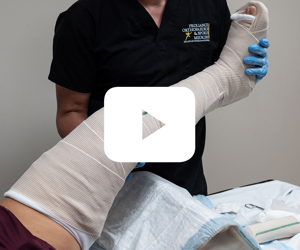 Physician Splinting Guide Proliance Orthopaedics Sports Medicine Physician Splinting Guide Proliance Orthopaedics Sports Medicine
